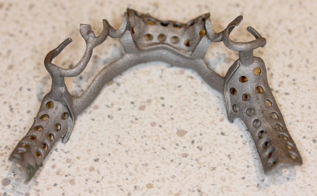 METALODONT Laboratoire de Prothèse Dentaire • MODELES IMPRIMES